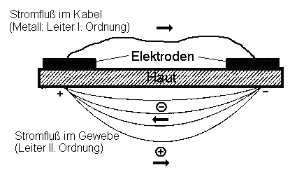 "Neue Wege in der Schmerzbehandlung - Elektrotherapie erstmalig als ...